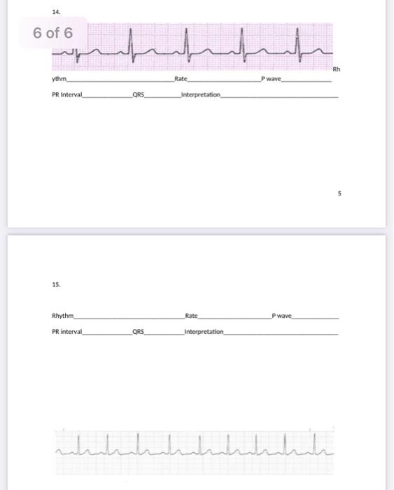 2. Rhythm Rate P wave PR interval QRS Interpretation. | Chegg.com