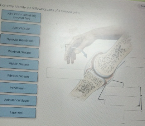 Solved Correctly identify the following parts of a symoval | Chegg.com