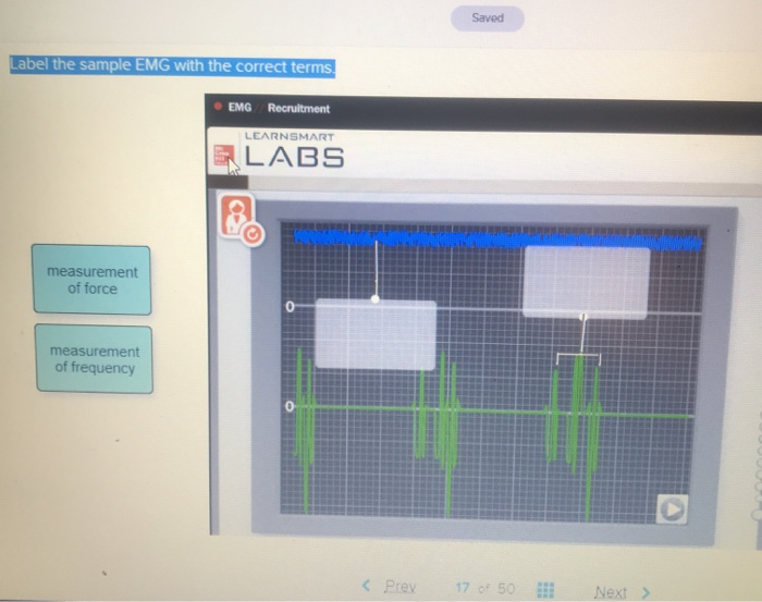 Solved Saved Label the sample EMG with the correct terms. | Chegg.com