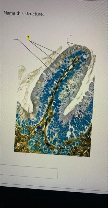 Solved Name this structure. | Chegg.com