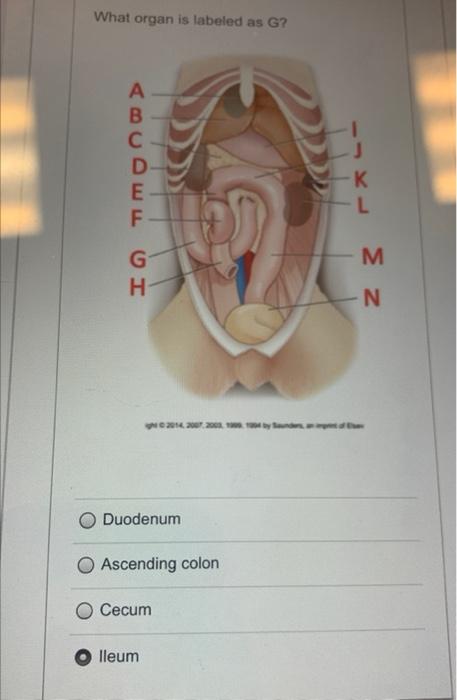 Solved What organ is labeled as G? Duodenum Ascending colon | Chegg.com