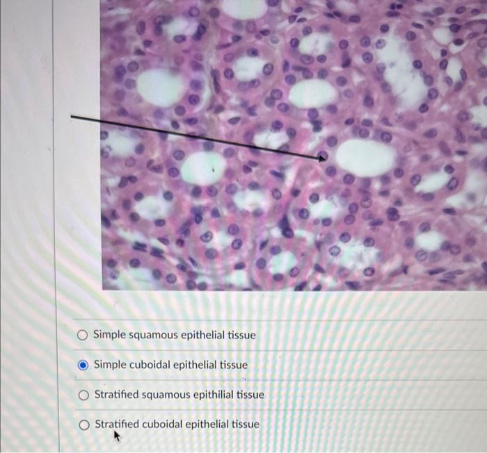 Solved Name the specific tissue at the end of the | Chegg.com