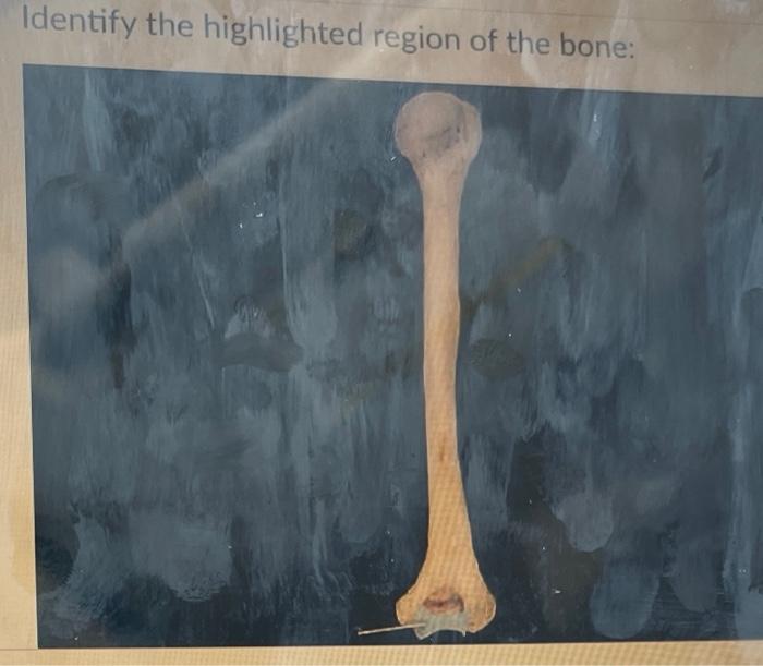 Solved Identify the highlighted structure on the bone: 1 | Chegg.com