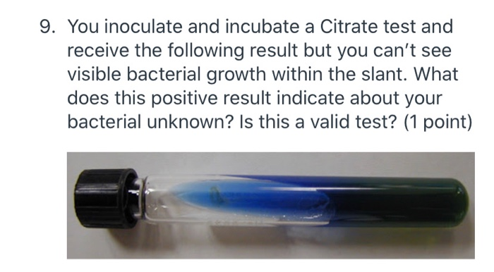 Solved 9. You inoculate and incubate a Citrate test and | Chegg.com