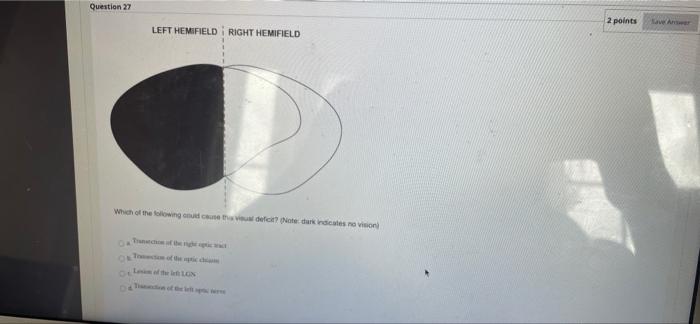 Solved Question 27 2 points LEFT HEMIFIELD RIGHT HEMIFIELD | Chegg.com