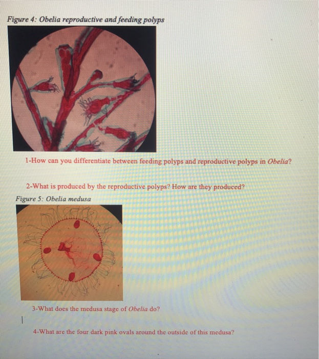 Solved Figure 4: Obelia reproductive and feeding polyps | Chegg.com