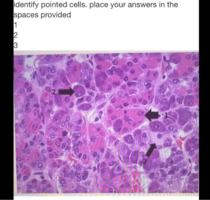 Solved identify pointed cells. place your answers in the | Chegg.com