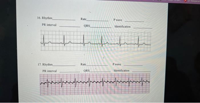 Solved 16. Rhythm Rate P wave PR interval QRS Identification | Chegg.com