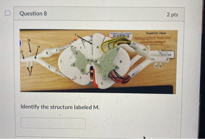 Solved Question 8 2 pts Superior view Autographed Anatomy | Chegg.com
