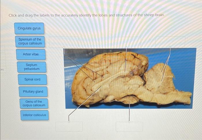 Solved Click and drag the labels to the accurately identify | Chegg.com