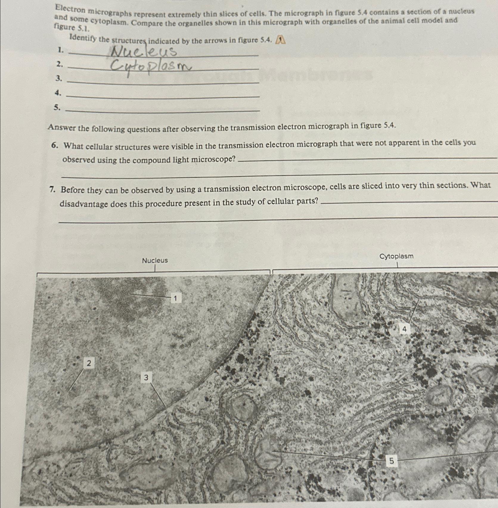 Solved Electron micrographs represent extremely thin slices | Chegg.com
