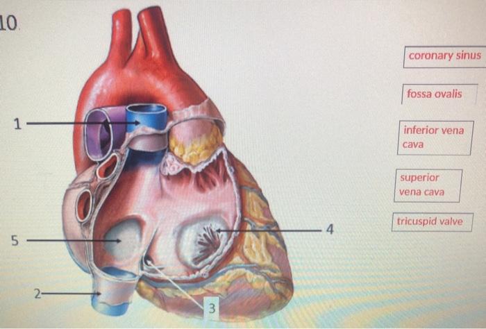 Solved SLIDE 6 left circumflex artery left marginal artery | Chegg.com
