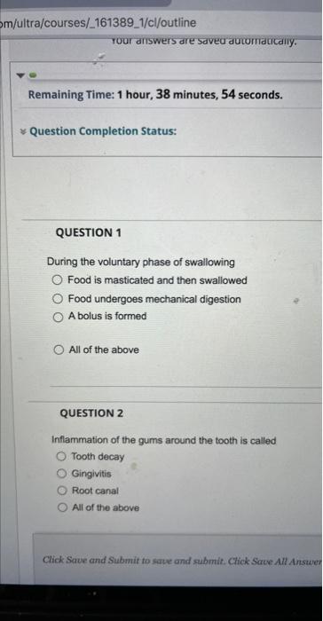 Solved During the voluntary phase of swallowing Food is | Chegg.com