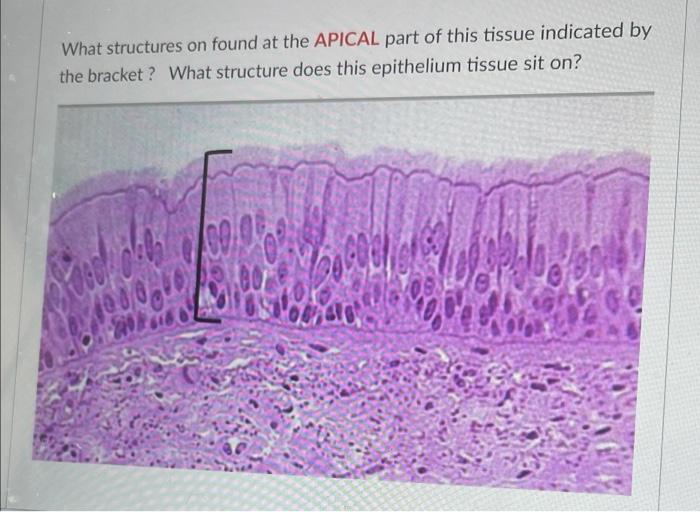 Solved What structures on found at the APICAL part of this | Chegg.com