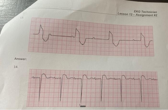 Solved Lesson 12 Assignment #2: Basic EKG Interpretation | Chegg.com