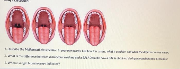 Solved 1. Describe the Mallampati classification in your own | Chegg.com