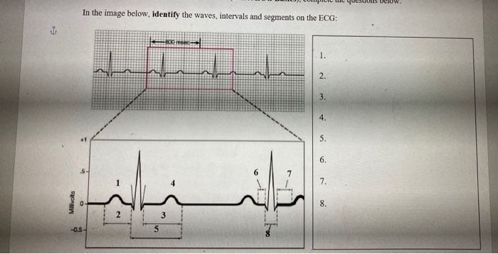Solved In the image below, identify the waves, intervals and | Chegg.com