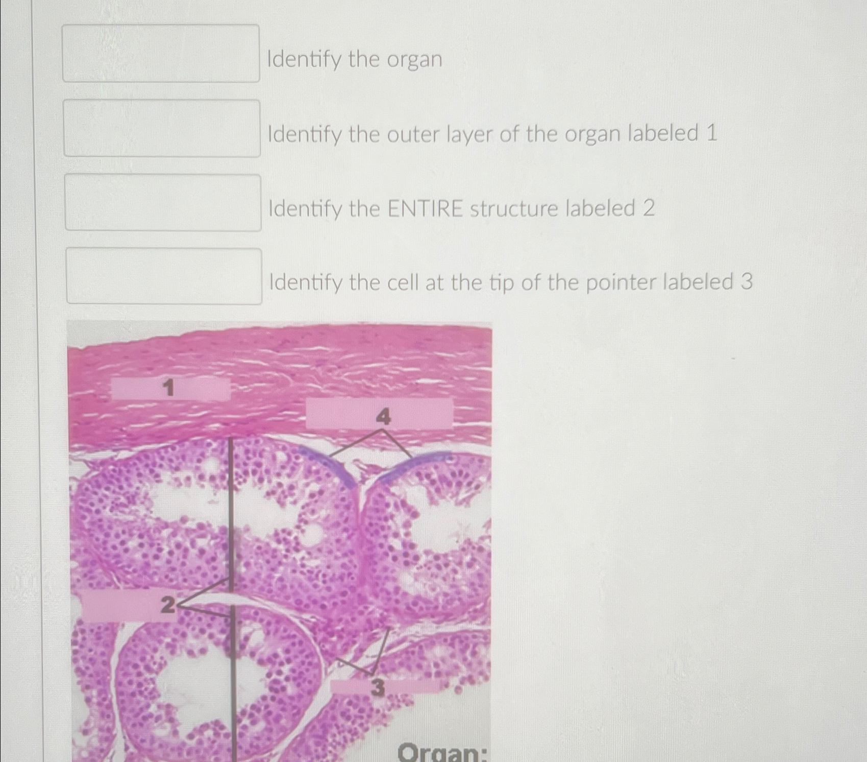Solved Identify the organIdentify the outer layer of the | Chegg.com