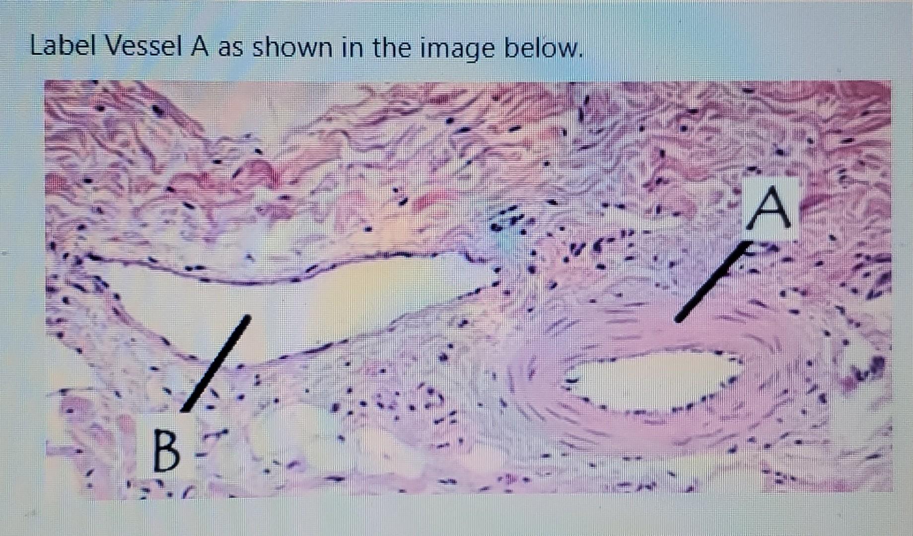 Solved Label structure 3 as shown in the image below.Label | Chegg.com