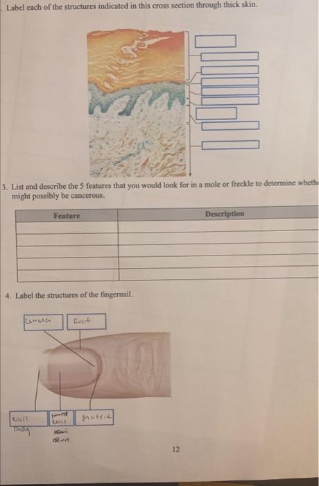 Solved Label each of the structures indicated in this cross | Chegg.com