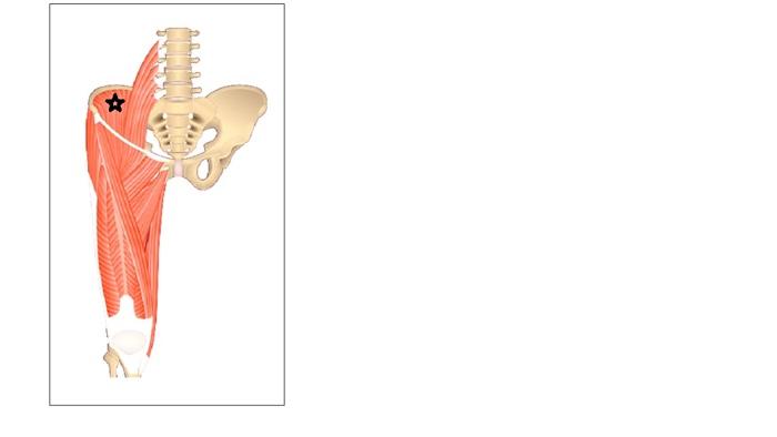 Solved Figure 1, Muscles of the Lower Limb (anterior | Chegg.com