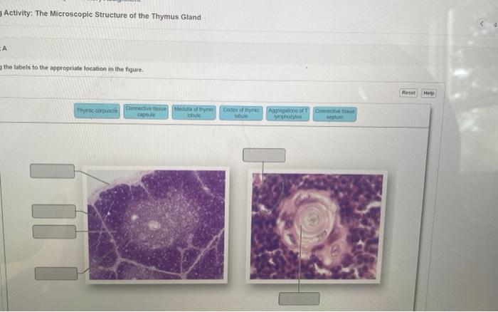 Solved Activity: The Microscopic Structure of the Thymus | Chegg.com
