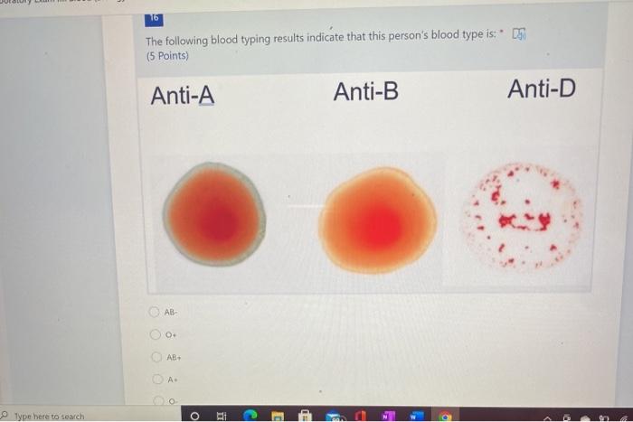 Solved 18 The blood typing results in this image indicate | Chegg.com