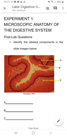 Solved 10:11 S.58% Osa Labó-Digestive-S... + Not saved yet | Chegg.com