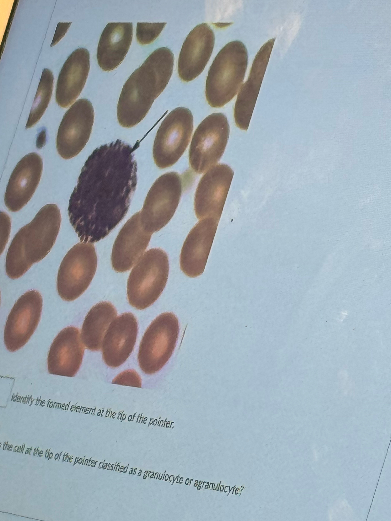 Solved Identify the formed element at the tip of the | Chegg.com