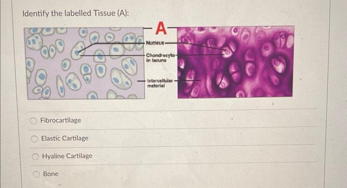 Solved Identify the labelled Tissue (A): Fibrocartilage | Chegg.com