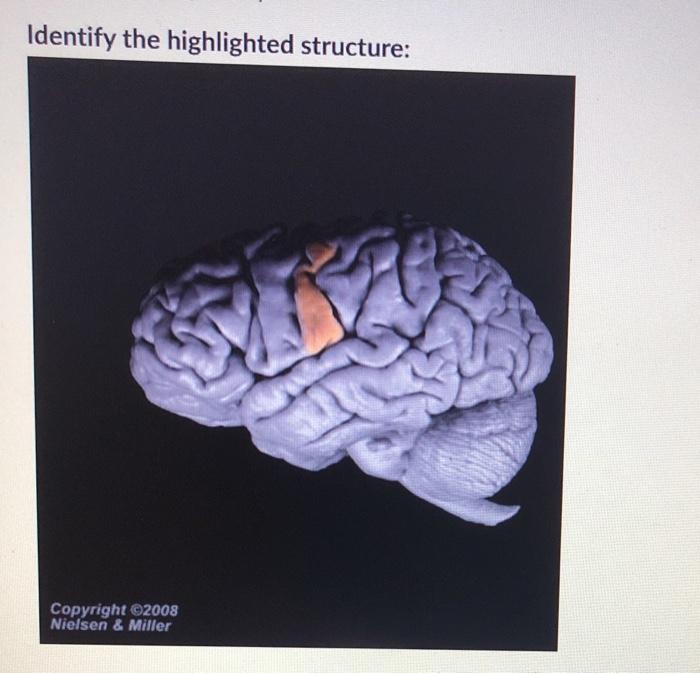Solved Identify the highlighted structure: Copyright ©2008 | Chegg.com