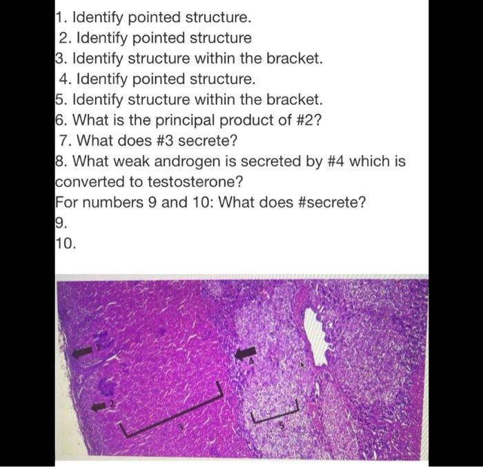 Solved 1. Identify pointed structure. 2. Identify pointed | Chegg.com Solved 1. Identify pointed structure. 2. Identify pointed | Chegg.com