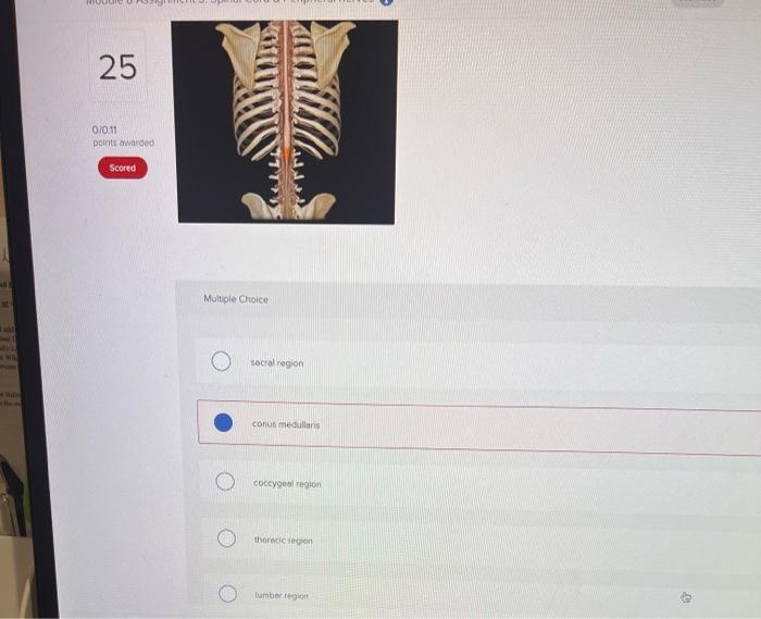 Solved Multigle Choice socral recion conus medullaris | Chegg.com