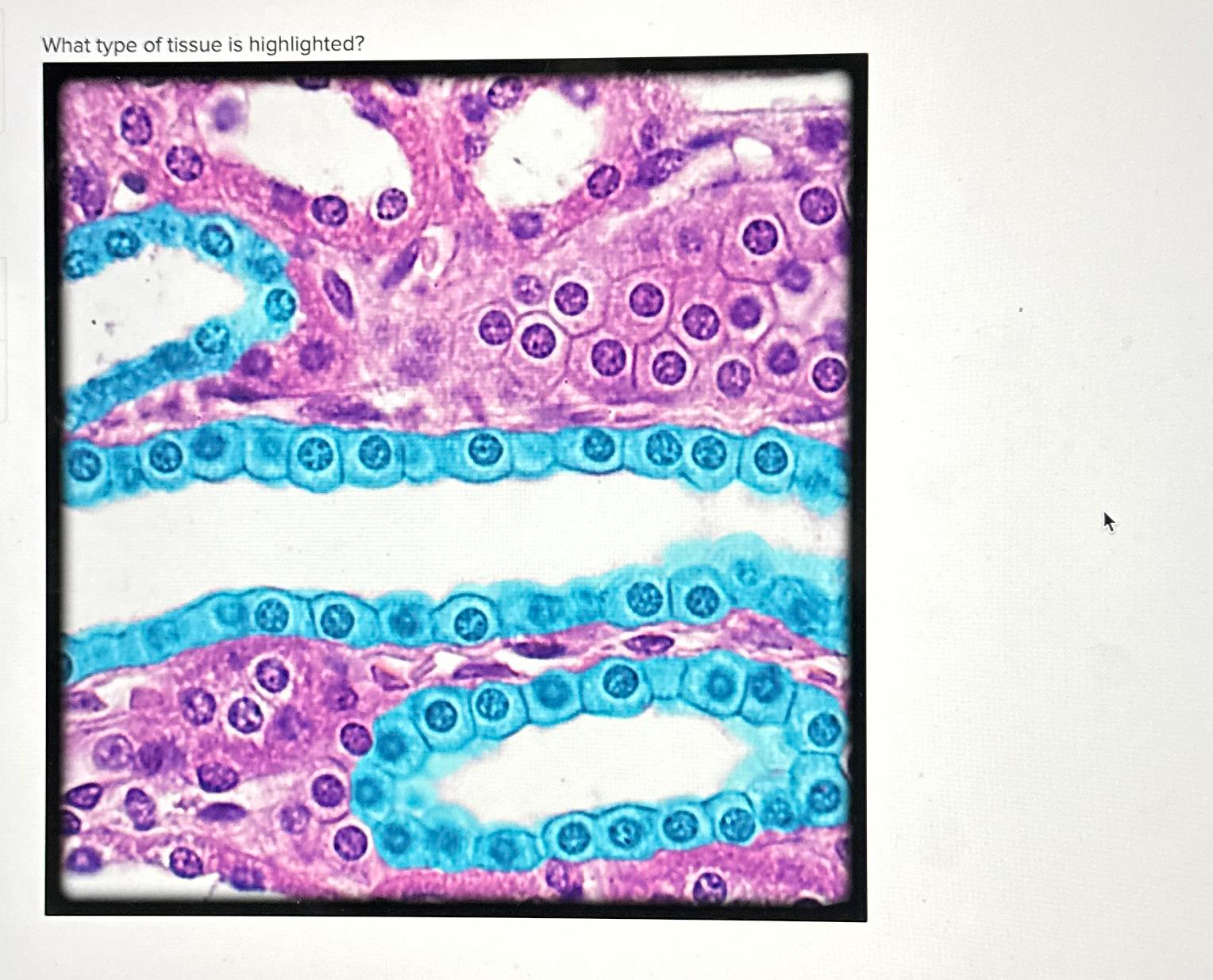 Solved What type of tissue is highlighted? | Chegg.com