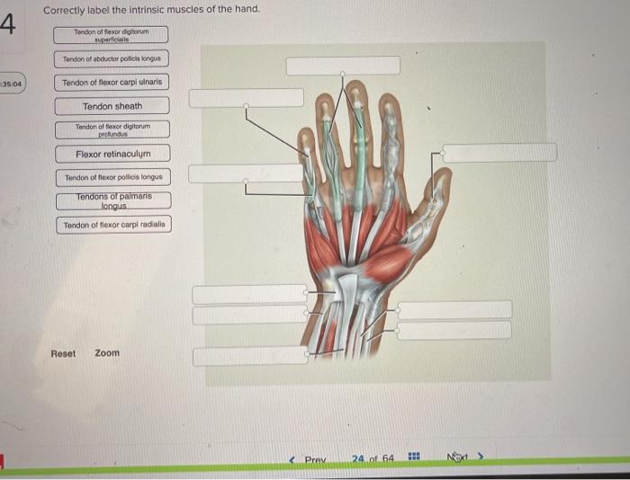 Solved Correctly label the intrinsic muscles of the hand. 4 | Chegg.com