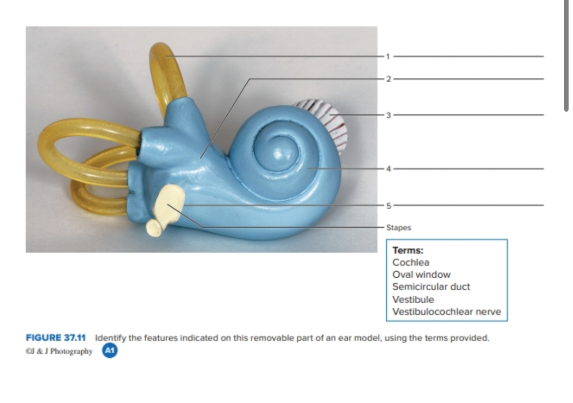 Solved FIGURE 37.11 ﻿Identify the features indicated on this | Chegg.com