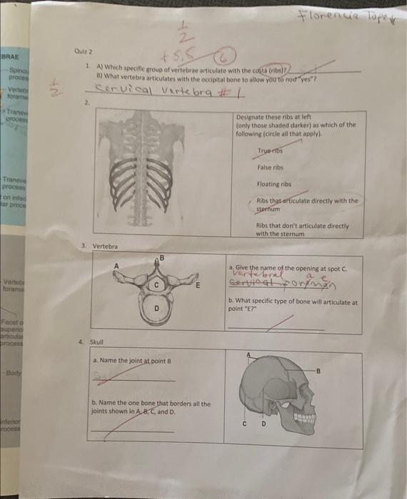 Solved BRAE Spinou proces Vertebi forame Transv process | Chegg.com