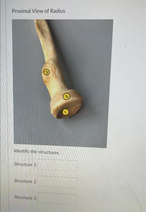 Solved Proximal View of Radius 3 Identify the structures. | Chegg.com
