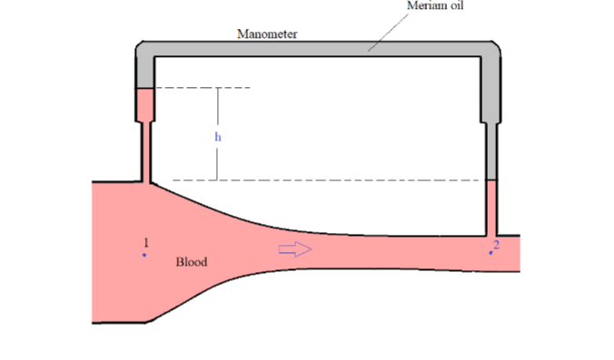 Solved An inverted U-tube manometer is connected between two | Chegg.com