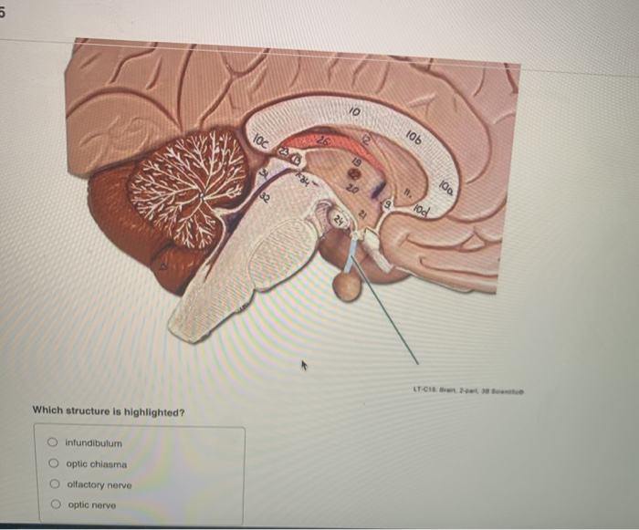 Solved UI TOC 106 100 32 lod LT.CIS Which structure is | Chegg.com