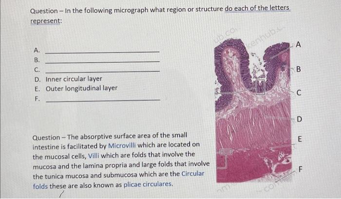 Solved Question - In the following micrograph what region or | Chegg.com