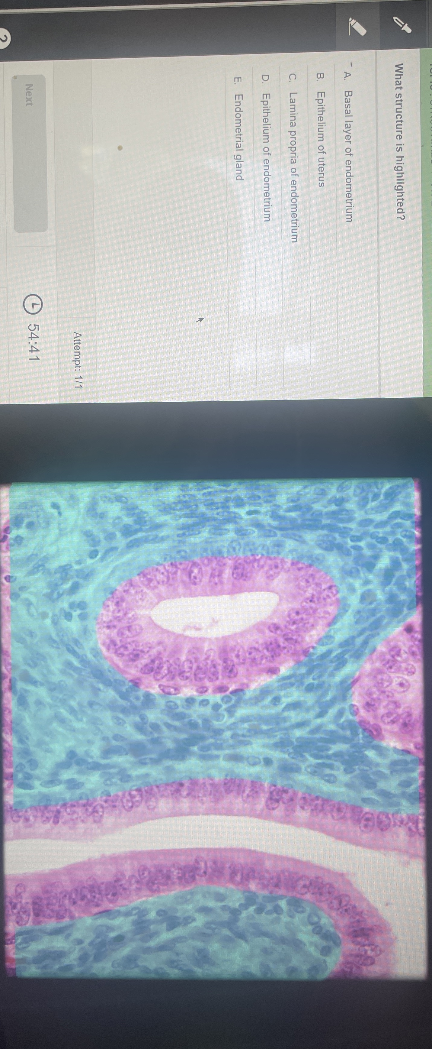 Solved What structure is highlighted?A. ﻿Basal layer of | Chegg.com