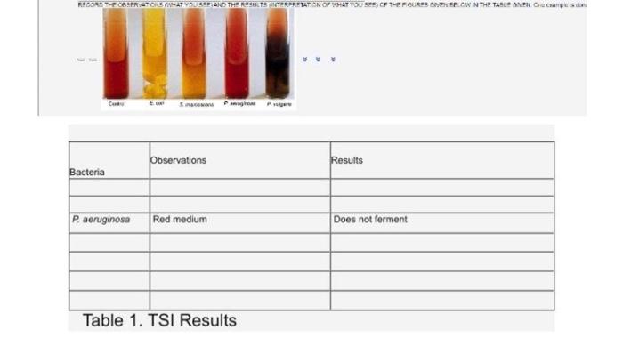 Group Activity - Carbohydrate Fermentation Hime | Chegg.com