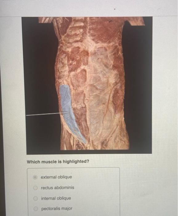 Solved 747 The highlighted muscle inserts onto two different | Chegg.com