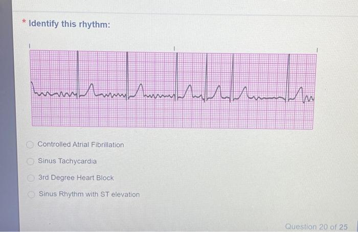 Solved Identify this rhythm: Controlled Atrial Fibrillation | Chegg.com