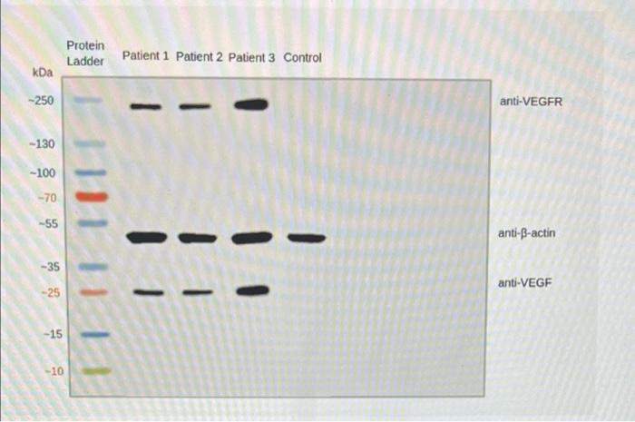 Solved Looking at the western blot result. What is your | Chegg.com