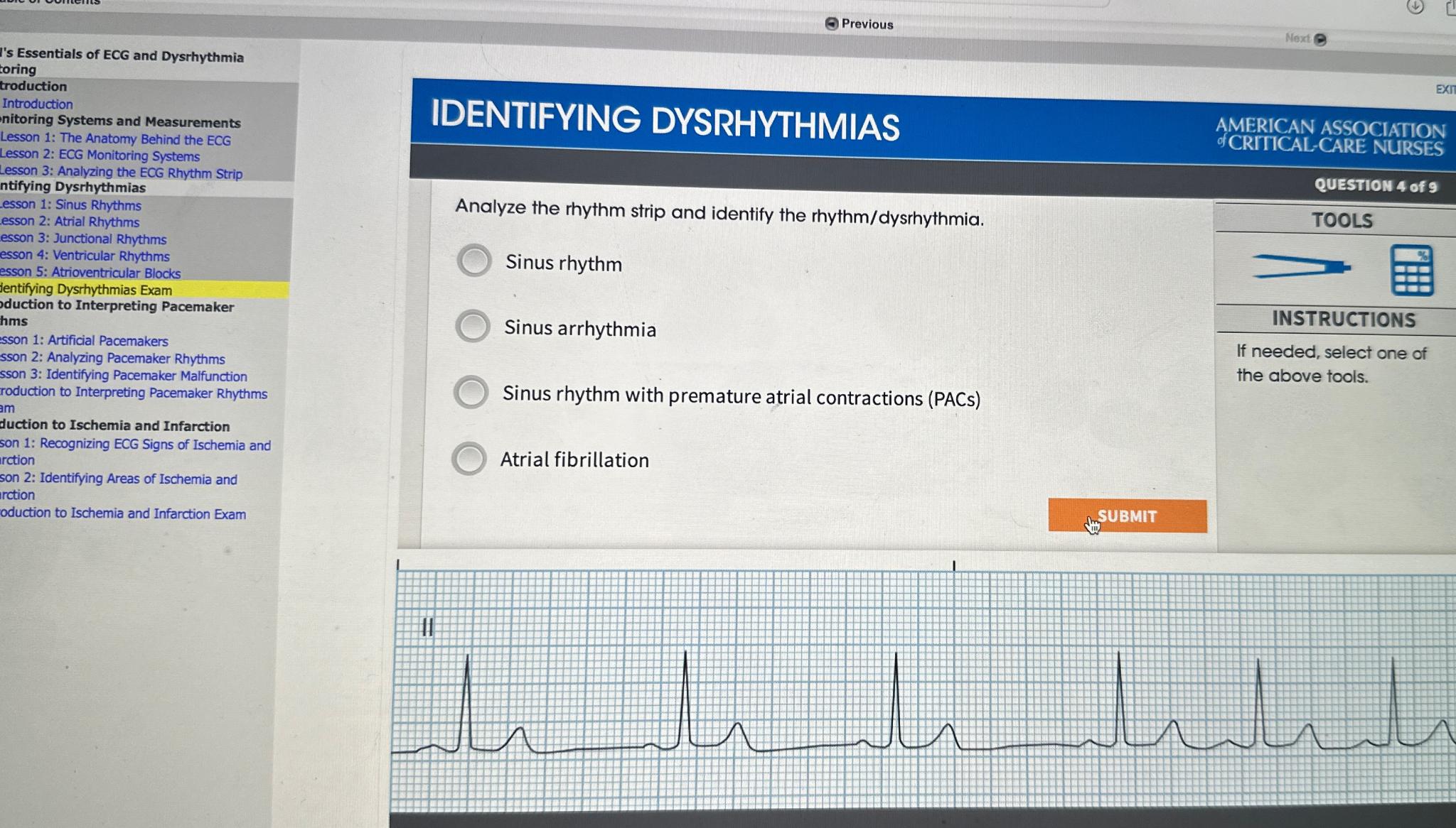 Solved (9) ﻿PreviousI's Essentials of ECG and Dysrhythmia | Chegg.com