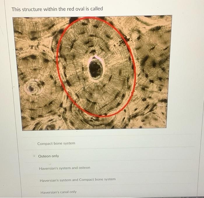 Solved Which of the following cartilage lacks perichondrium? | Chegg.com