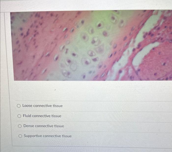 Solved Identify this tissue: Loose connective tissue Fluid | Chegg.com