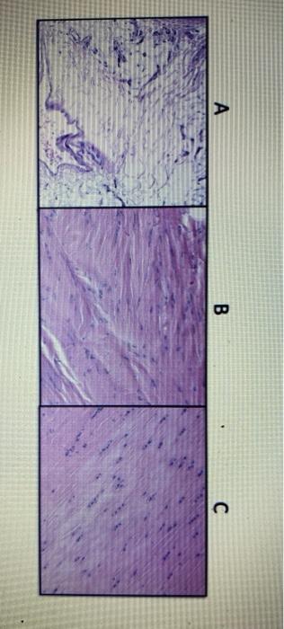 Solved label which is Dense regular connective tissue, loose | Chegg.com